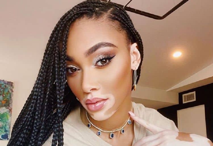 10 Things You Didn’t Know About Winnie Harlow – TVovermind