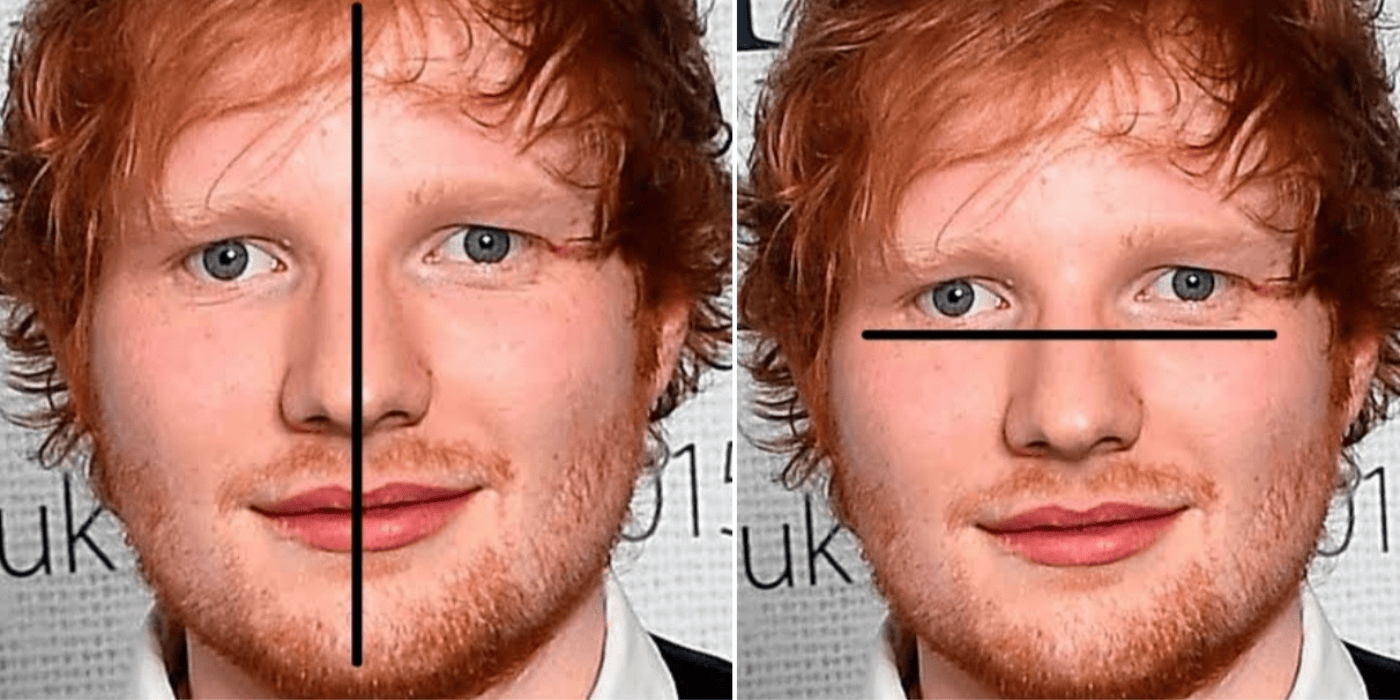 10 Celebrities With Asymmetrical Faces – TVovermind